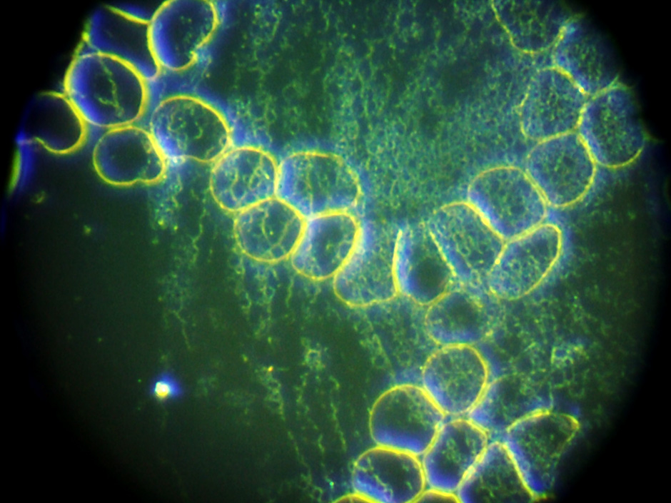 Microscopy of Spirochaete Biofilm | Madison Area Lyme Support Group
