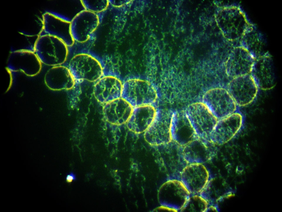 Microscopy of Spirochaete Biofilm | Madison Area Lyme Support Group