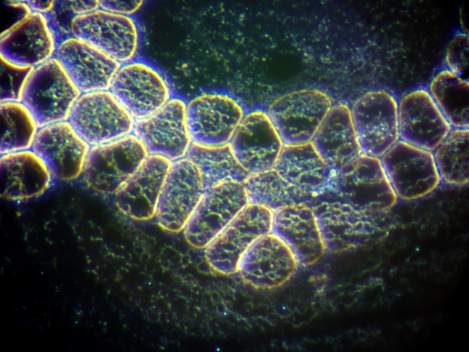 Microscopy of Spirochaete Biofilm | Madison Area Lyme Support Group